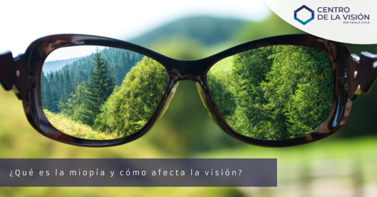 ¿Qué es la miopía y cómo afecta la visión? - Centro de la Visión